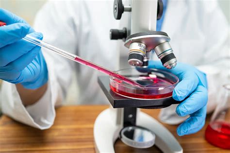 Análisis de laboratorio para detectar piedras en la vesícula Clínica