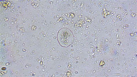 400X Naked Amoeba YouTube