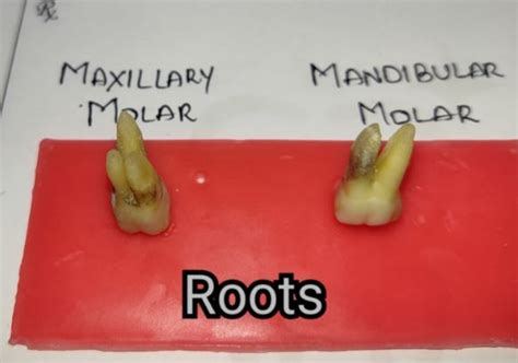 Differences Between Maxillary And Mandibular Molars Permanent