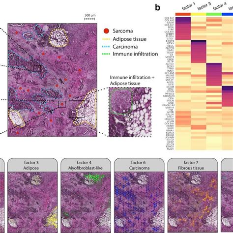 Analysis Of A Coronal Section From FFPE Mouse Brain Tissue A H E