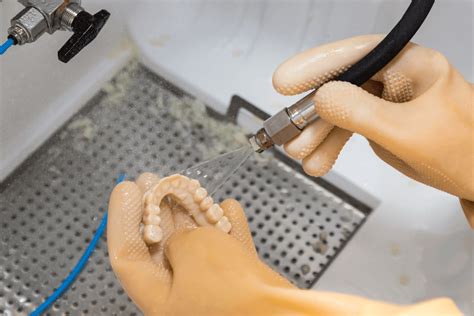 Especializa O Em Pr Tese Dent Ria Dicas Antes De Iniciar Nessa Carreira