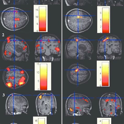 a brain activation for resting fmri left column and task fmri right download scientific