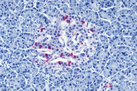 Delta Cells In A Pancreas Islet Photograph By Carolina Biological
