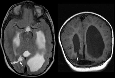 Neuroradiology Brain Radiology Key