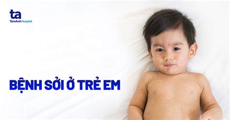 Benh Ban Do O Tre Em Sale Emergencydentistry