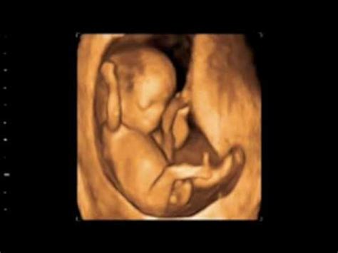 Faszinierende Ultraschallbilder Zur Entwicklung Des Kindes SHMK