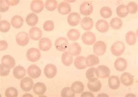 Kostenlose Bild Plasmodium Ovale Jung Ring Parasit