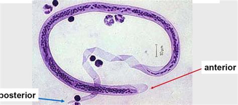 Parasitology Lab Exam Flashcards Quizlet