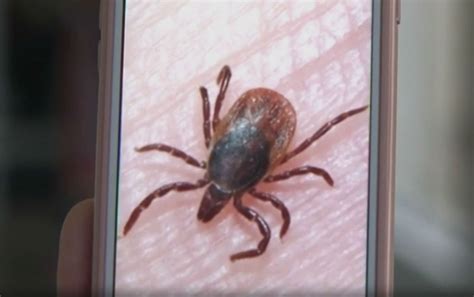 Mogi Mirim confirma duas mortes por febre maculosa uma das vítimas é