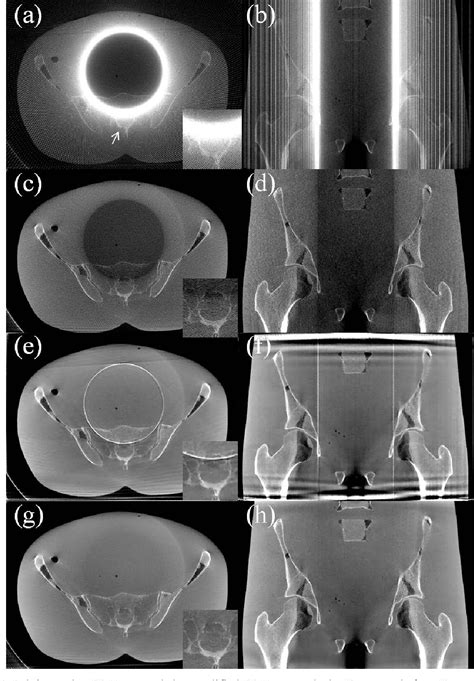figure 5 from fused analytical and iterative reconstruction air via modified proximal