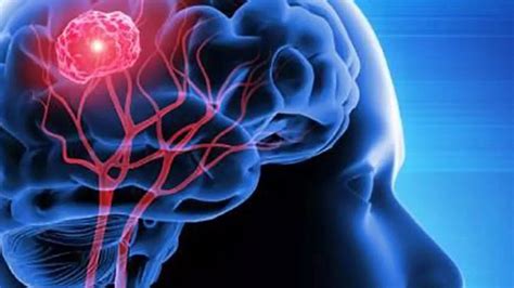 Brain Hopeful Discovery For The Fight Against Cancer Hours World