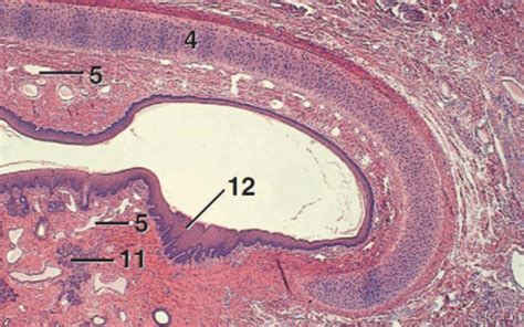 Respiratory Histology Lecture Flashcards Quizlet
