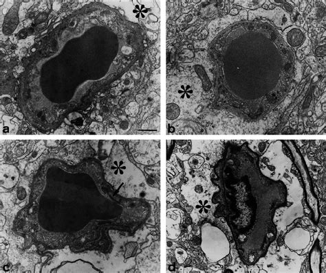 Electron Micrographs Of Brain Sections From Different Transgenic Mouse