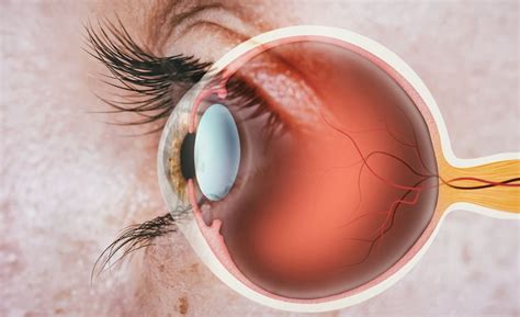 DMRI Você sabe o que causa a Degeneração macular relacionada a idade