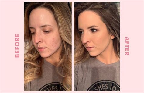How To Cover A Scab W Makeup Makeupview Co