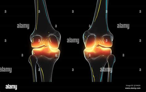 Painful Knee Joints Illustration Stock Photo Alamy