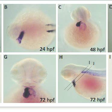 Mybpc Expression Patterns During Zebrafish Embryogenesis A Through D