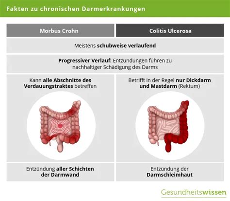 Chronisch entzündliche Darmerkrankungen CED Ursachen Symptome