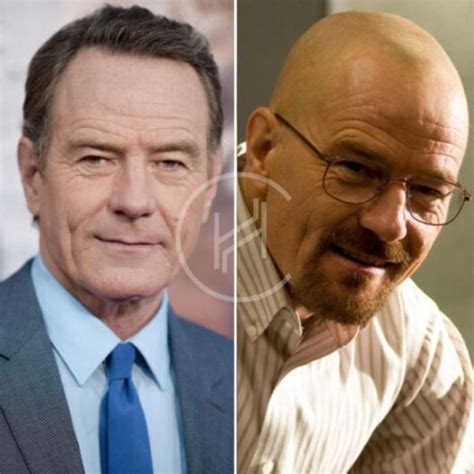 Hair Transplant Vs Shaved Head What Makes You Look Your Best