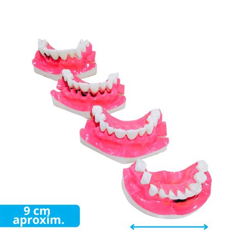 Macro modelo de Evolução das Doenças Periodontais