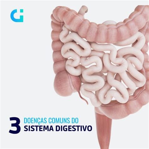 Doen As Comuns Do Sistema Digestivo Giovanardi