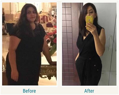 Gastric Bypass Imed Medical