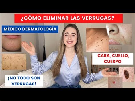 Todo lo que necesitas saber sobre las verrugas en la piel según la