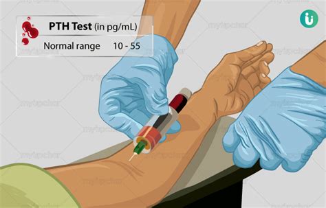PTH Parathyroid Hormone Test Procedure Purpose Results Normal