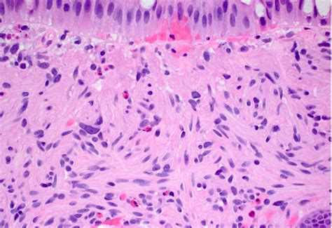 Schwann Cells Histology
