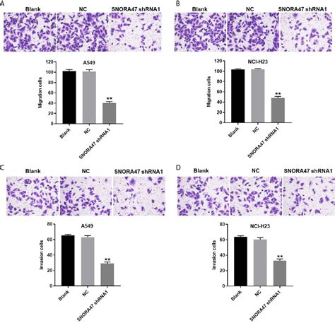 Frontiers Knockdown Of SNORA47 Inhibits The Tumorigenesis Of NSCLC
