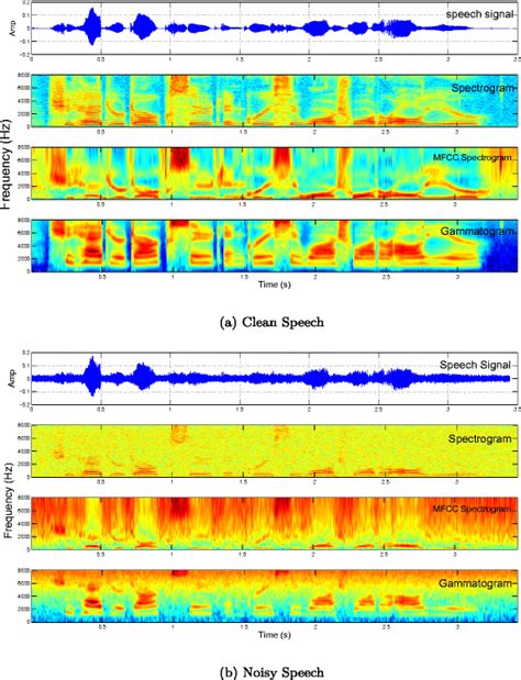 speech signal spectrogram mfcc spectrogram and gammatongram of female download scientific