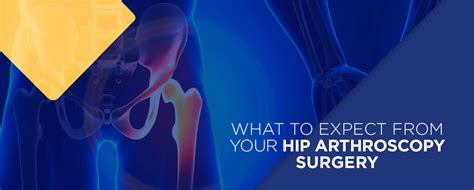 What To Expect From Your Hip Arthroscopy Surgery