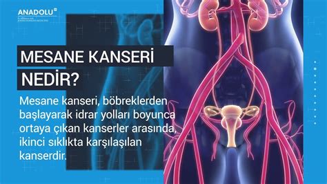 Mesane kanseri nedir Mesane kanseri nasıl tedavi edilir YouTube