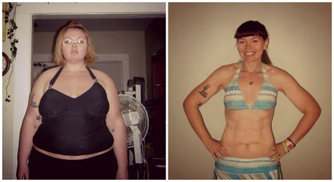 Why I Chose To Keep My Loose Skin After Weight Loss HuffPost Life