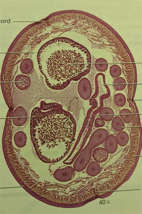 Gen Bio 143 Dr Haenni Ascaris Lumbricoides Female Cross Section