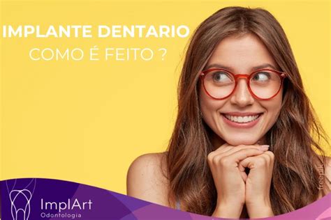 IMPLANTE DENTARIO COMO É FEITO ImplArt