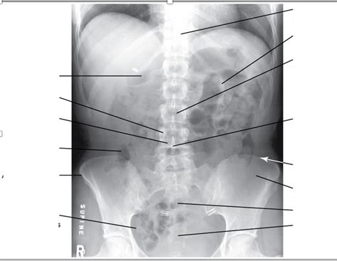 Abdomen Diagram Quizlet