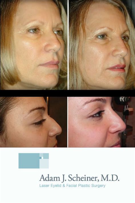 Learn How You Can Create An Entirely New Look With Just Five Minutes