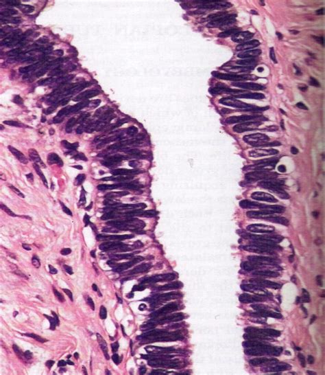 Pathology Outlines Anatomy Histology Embryology Features To Report