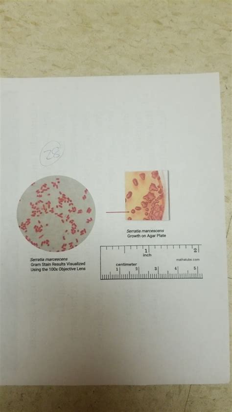 Serratia Marcescens Colony Morphology