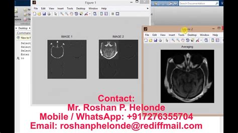 matlab code for image fusion using wavelet transform youtube