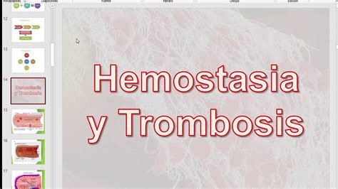 Trastornos hemodinámicos enfermedad tromboembólica y shock YouTube