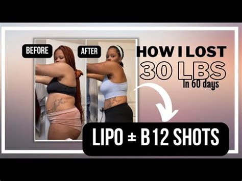 I Lost Pounds In Days Heres How Lipo B Weightloss