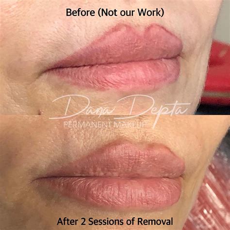 Permanent Makeup Gone Wrong