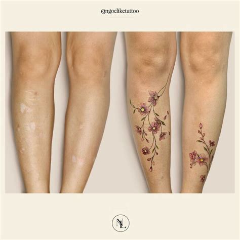 Details More Than Leg Scar Cover Up Tattoos Best In Cdgdbentre