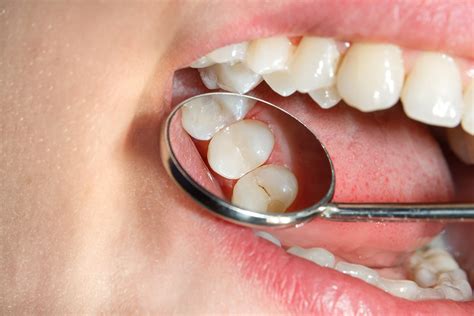 Qué es la salud bucodental Los mejores consejos para tu salud