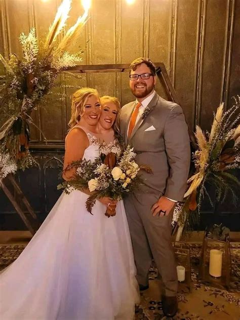 Vídeo do casamento de gémeas siamesas enfermeiro torna se viral