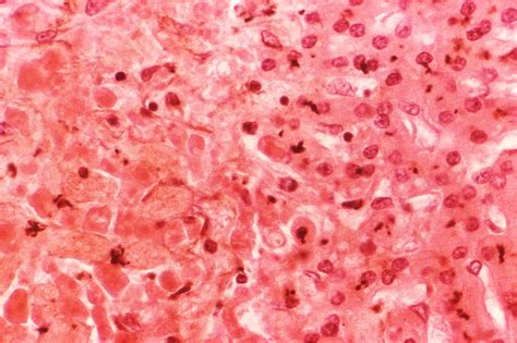 Public Domain Picture Under A High Magnification Of 320X This