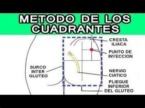INYECTOTERAPIA METODO DE LOS CUADRANTES VIA INTRAMUSCULAR 2021