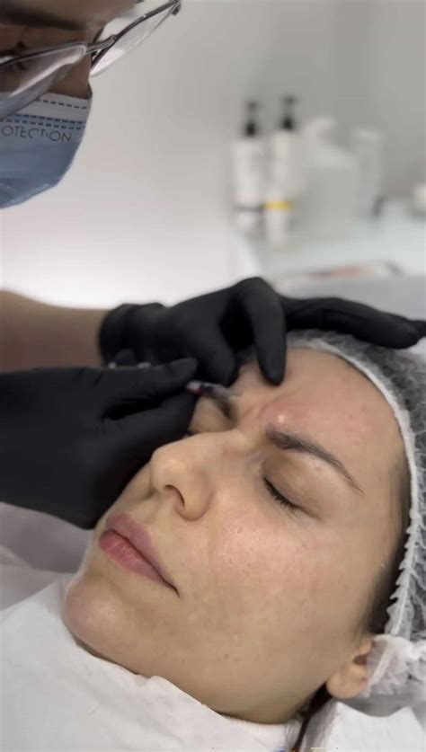Botox Wroc Aw Botoks Wroc Aw Toksyna Botulinowa Wroc Aw Typu A